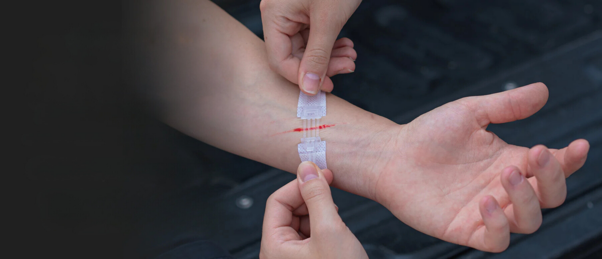 ZipClose – Needle and Stitch Free Wound Closure